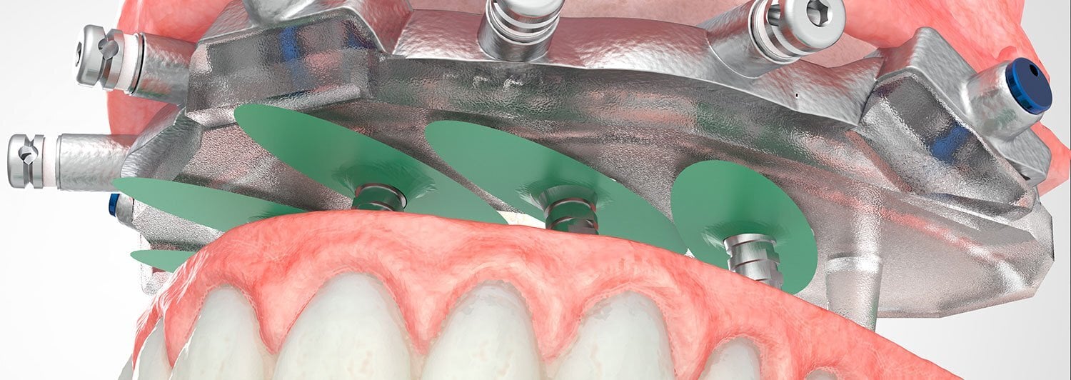 CHROME GuidedSMILE