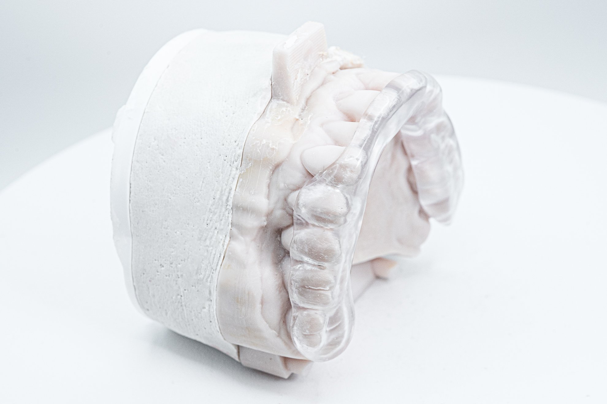CLEARsplint™