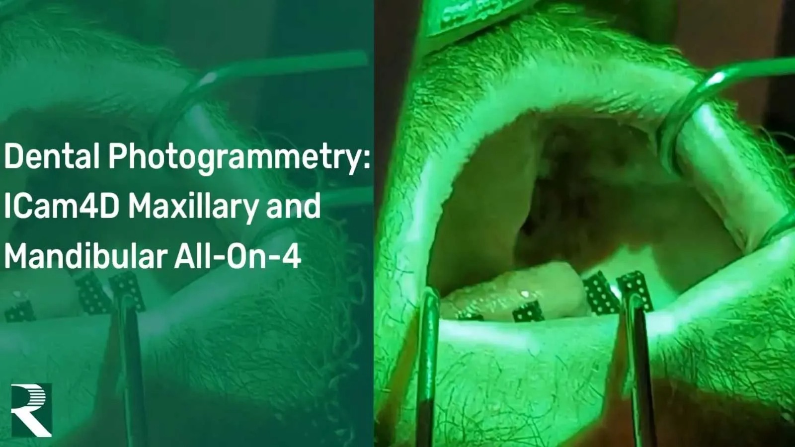 Dental Photogrammetry