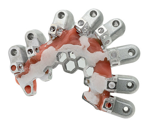 Grammetry - OptiSplint