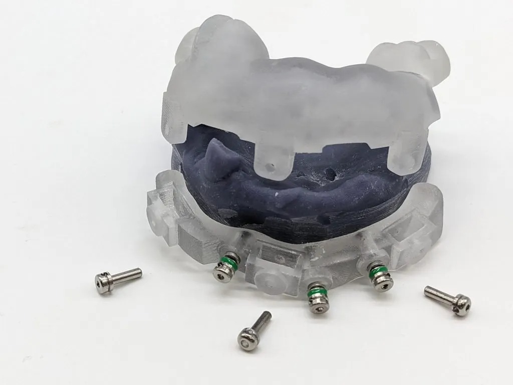 Dental Photogrammetry