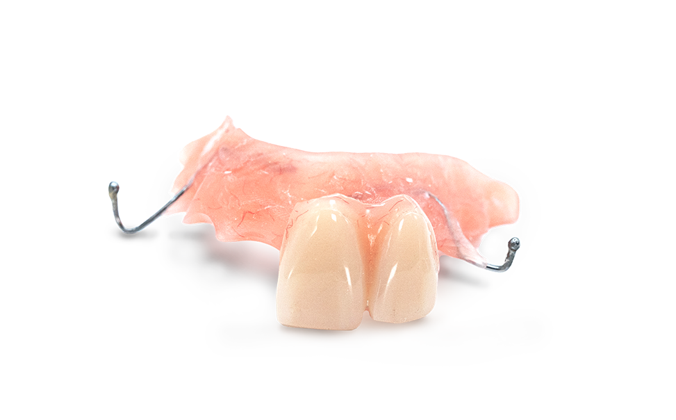 All-Acrylic Partial (Flipper)