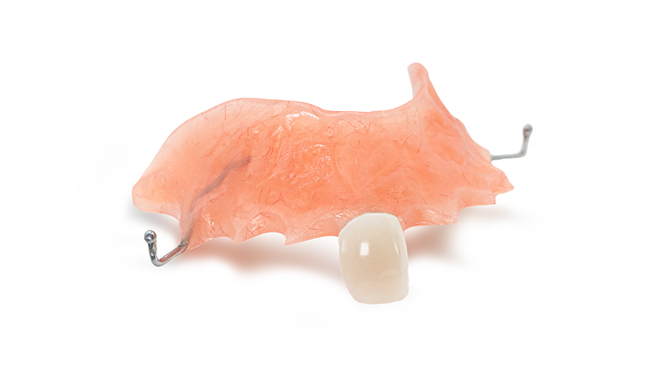 All-Acrylic Partial (Flipper)