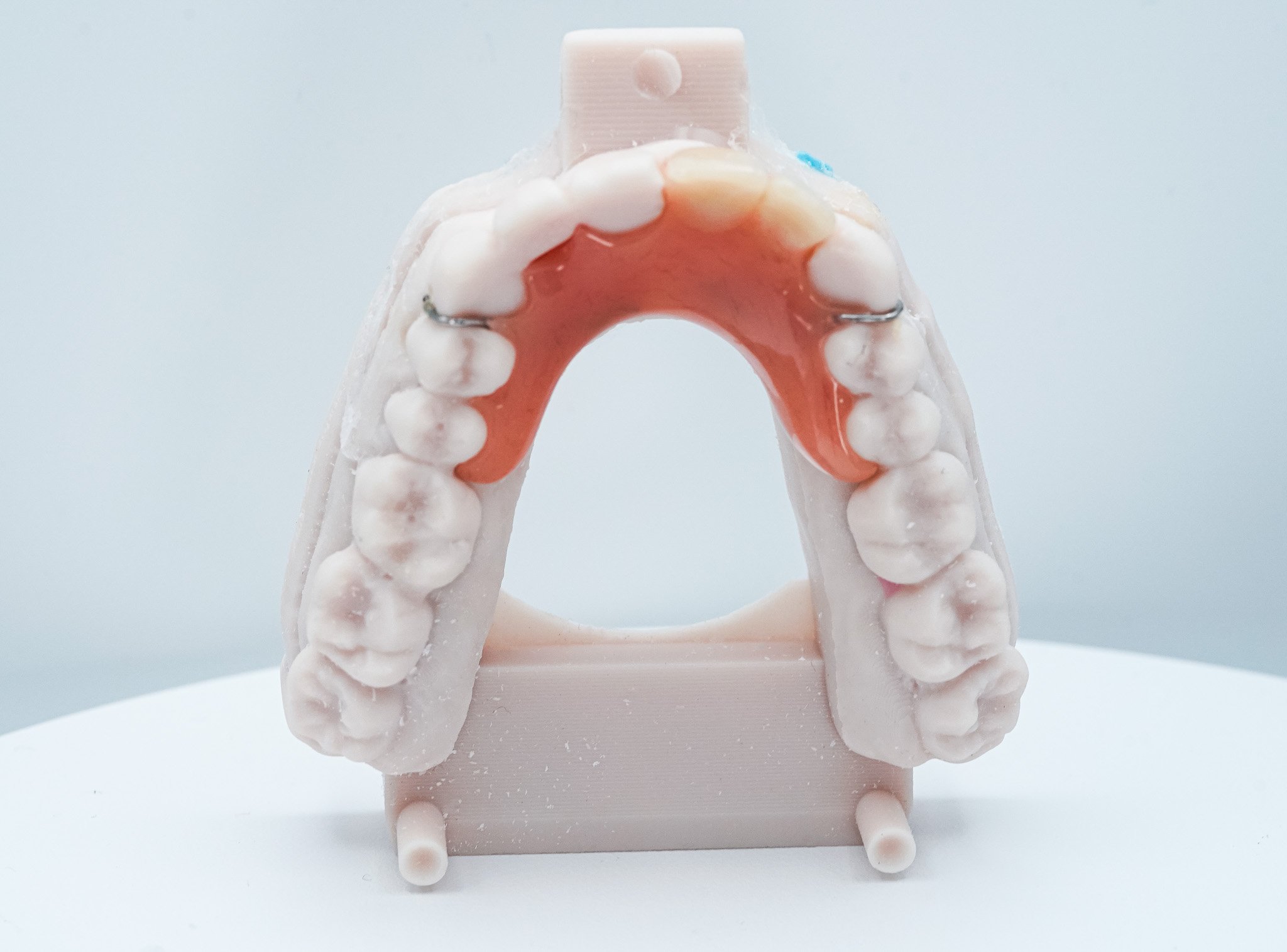 All-Acrylic Partial (Flipper)