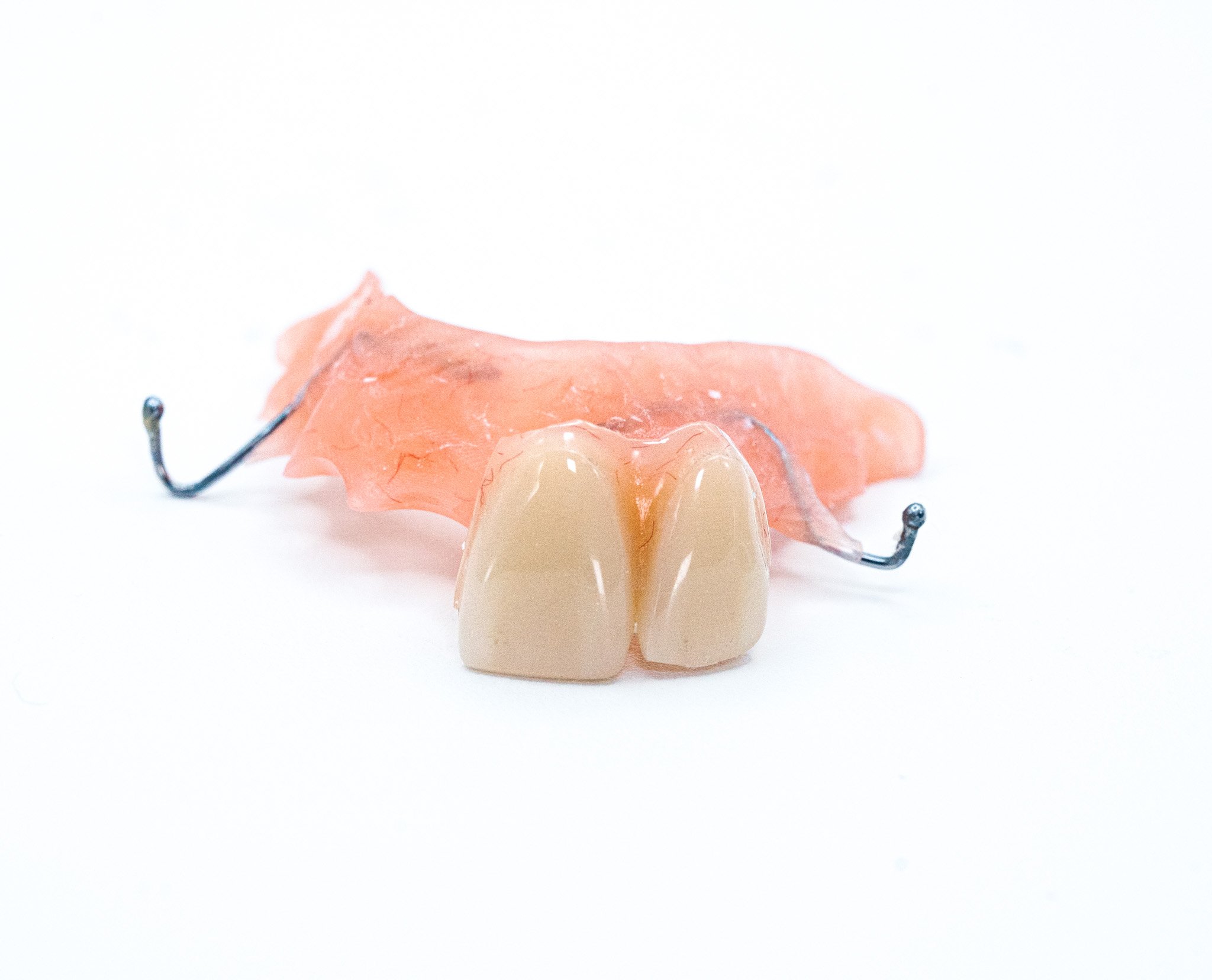 All-Acrylic Partial (Flipper)