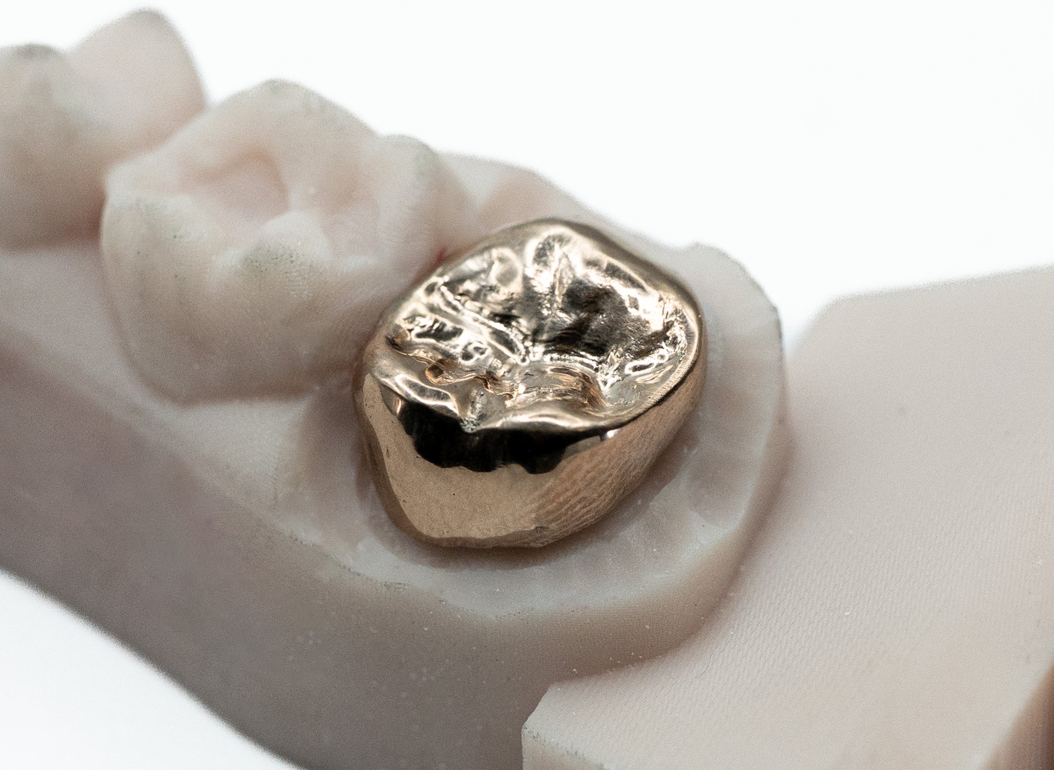 Full Cast Gold Metal