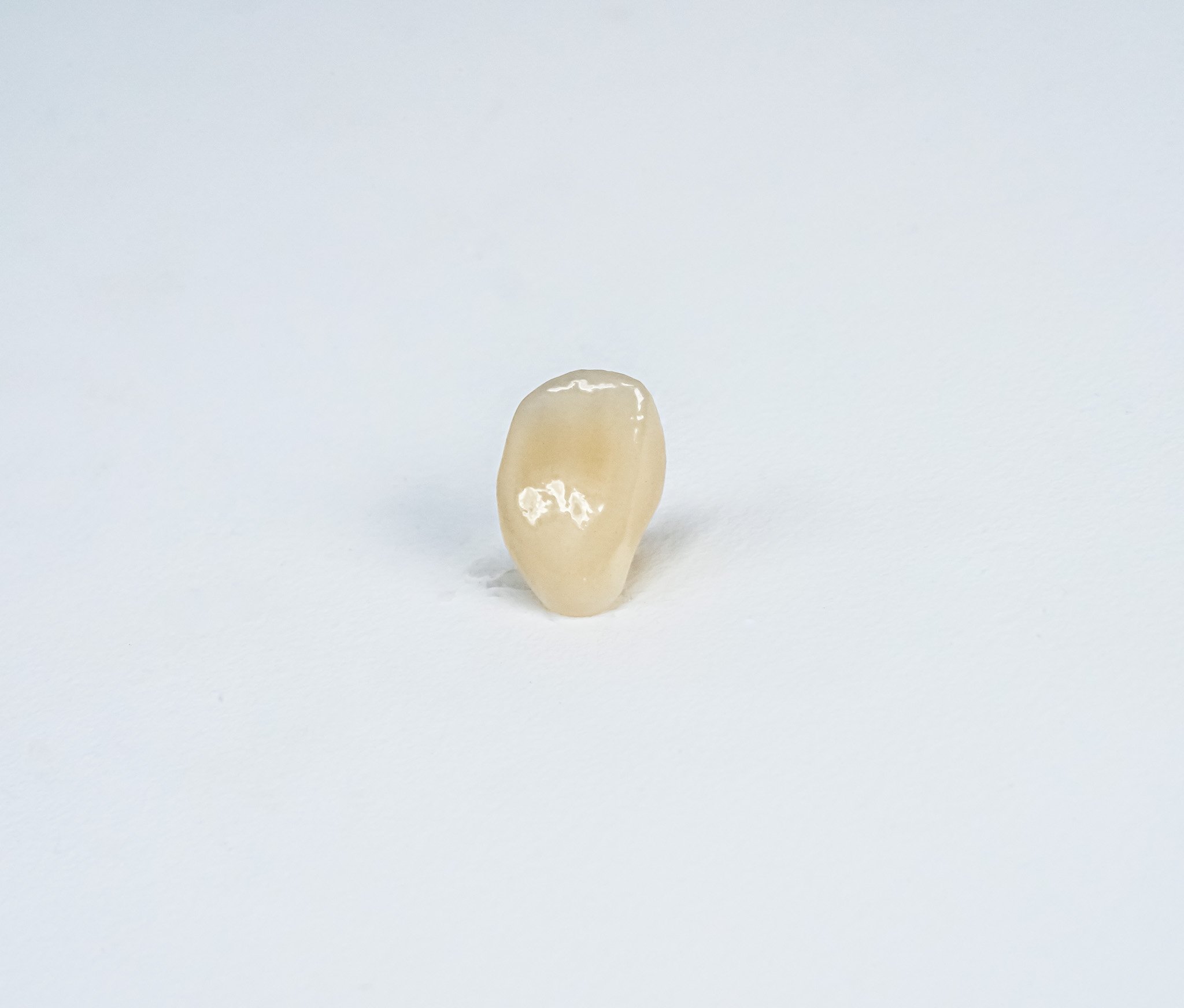 IPS e.max® Monolithic