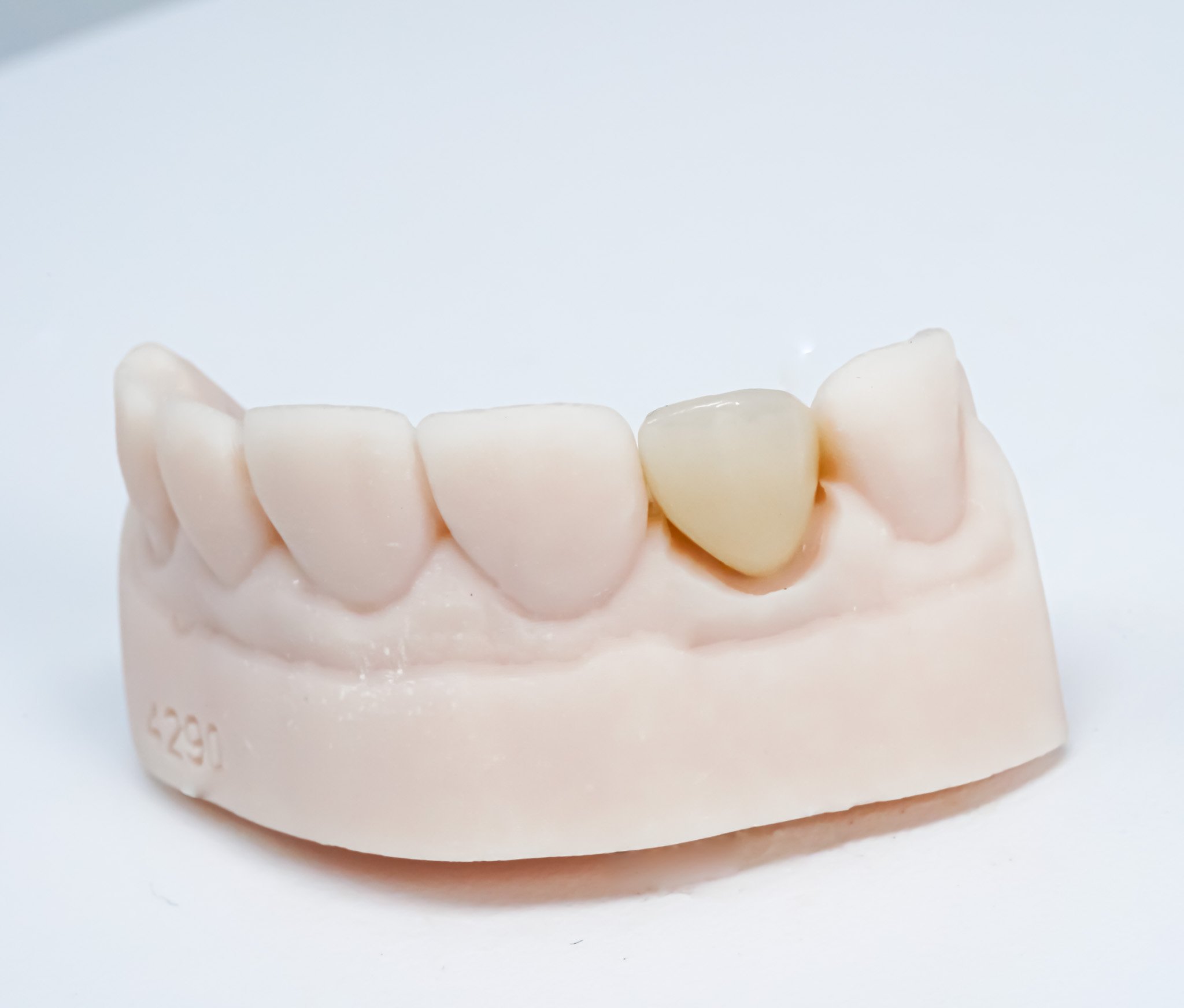 IPS e.max® Monolithic