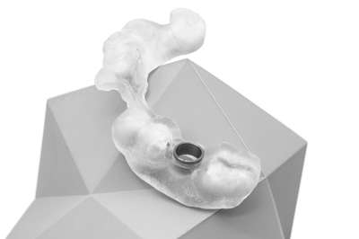 Tooth Supported Surgical Guide