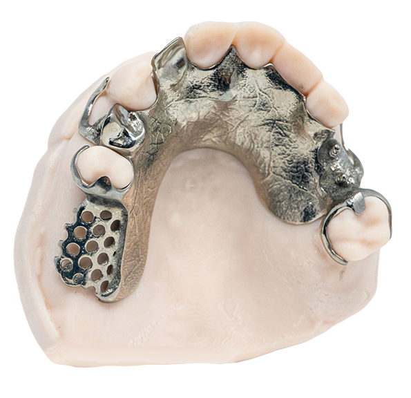 SLM Titanium Partial Dentures