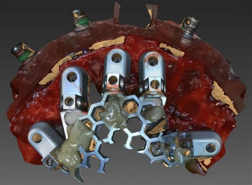 Grammetry™