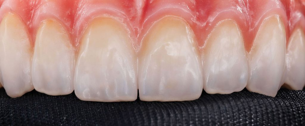 Bespoke - Teeth Options