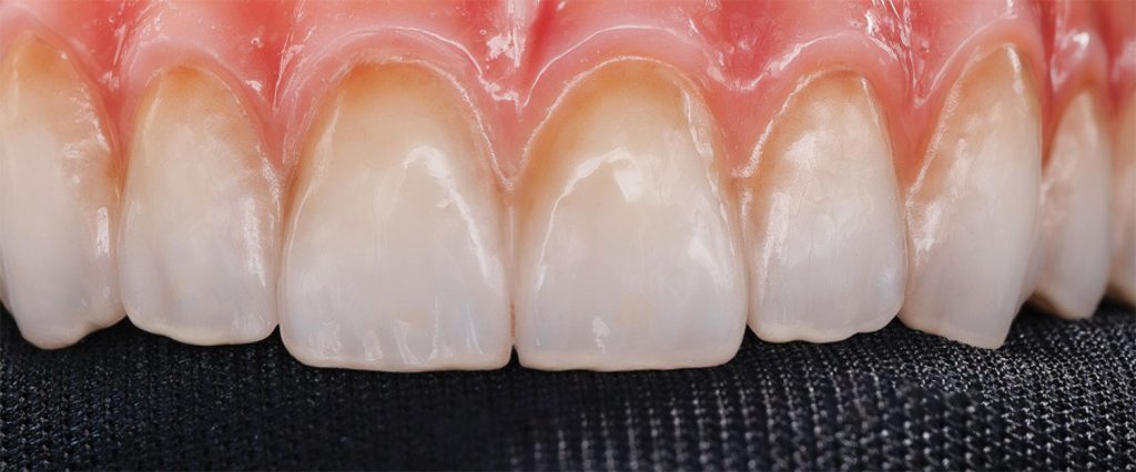Bespoke - Teeth Options