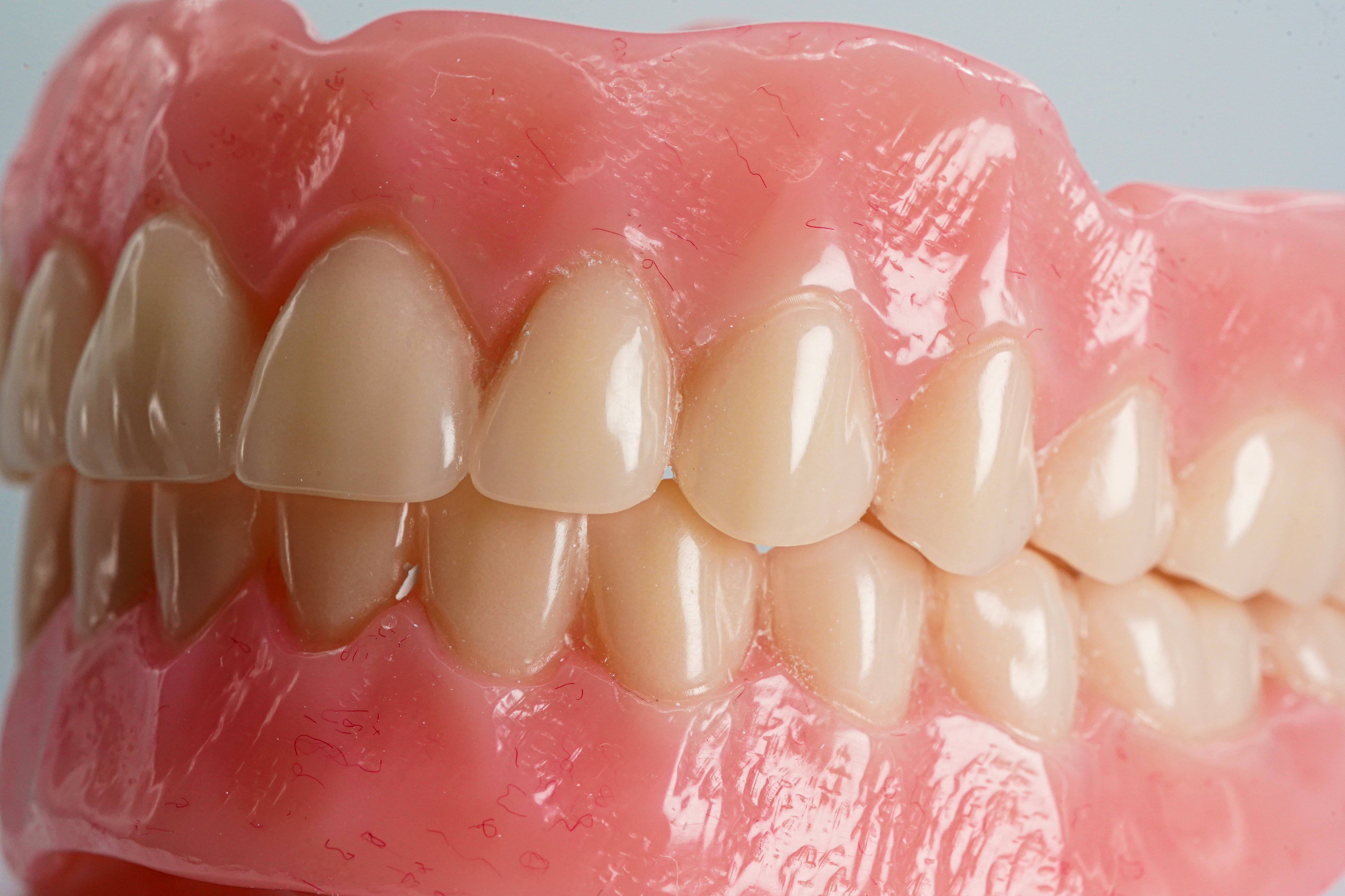 Traditional Dentures